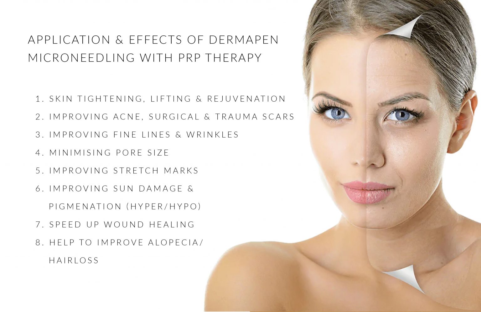 Dermapen Micro-Needling with PRP | Best Plastic & Cosmetic Surgery ...